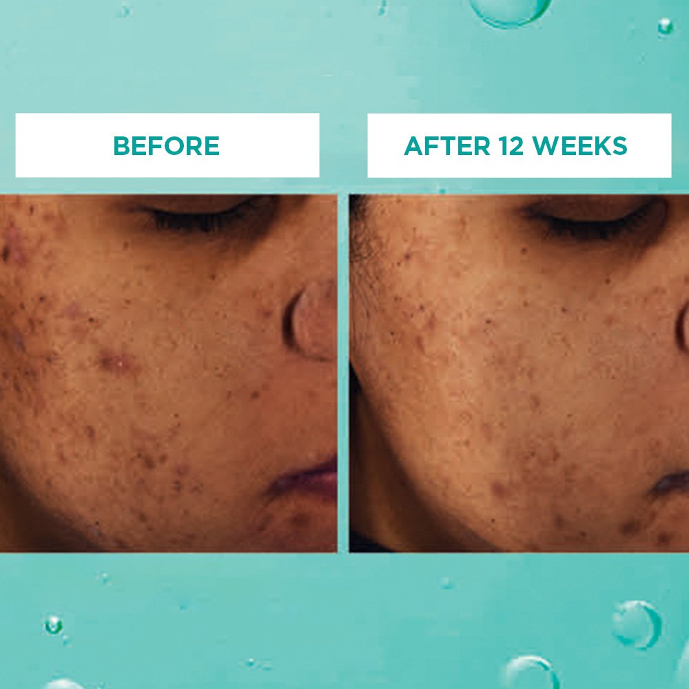 Bright Reveal | L'Oréal Paris